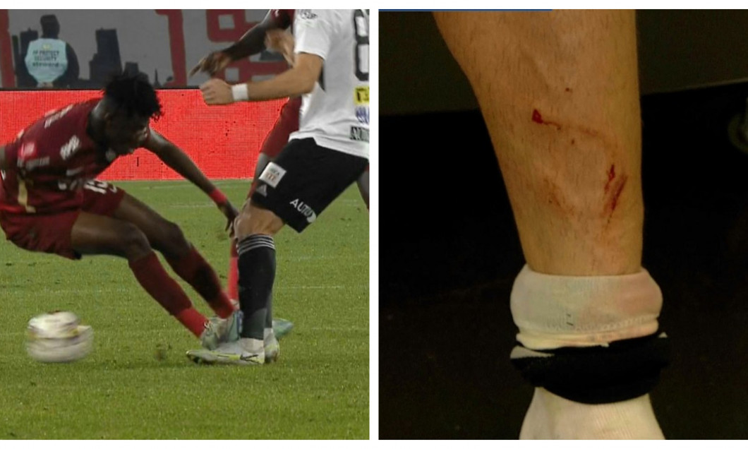 Fulop, nervos după meci: „Îmi rupe piciorul, arbitrul mă ia cu «mă ...